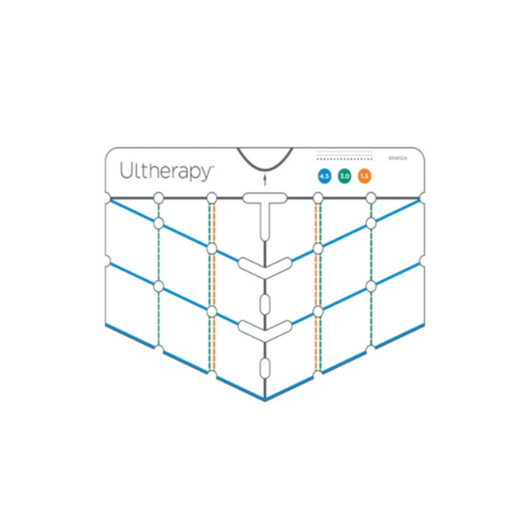 ULTHERAPY® CHEST STENCIL – Merz Aesthetics EPrint